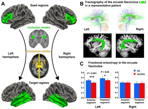 Arcuate Fasciculus Measurements A Seed And Target Regions As Well