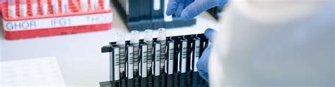 Automated Tb Testing Tb Test Solution Quantiferon