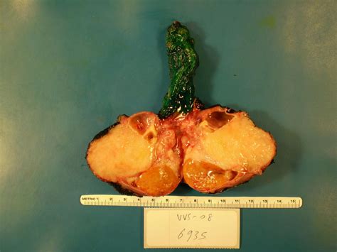 Case Of The Week 148