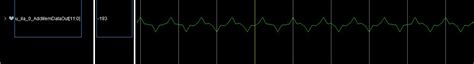 Fpga Reading Data From Serial Lvds 12bit Adc Into Kintex 7 Using