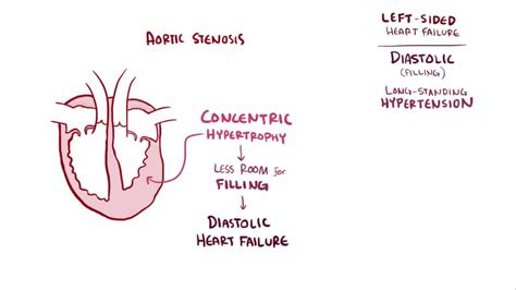 Msd Manual Professional Edition