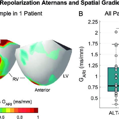 Interaction Between Alternans And Spatial Gradients Of Repolarization