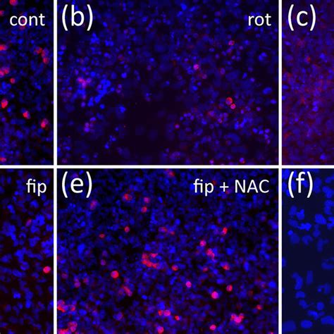 Neuronal Differentiation Assay Nt2 Cells Immunolabeled For ß Tubulin