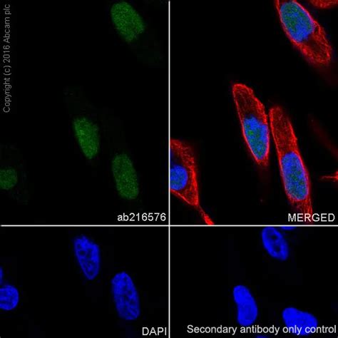 Anti Dusp4 Antibody Epr19881 Ab216576 Abcam