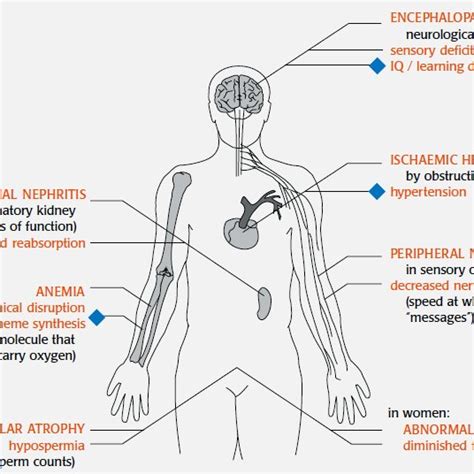 10 Schematic Diagram Showing The Float Process For Making Sheet Glass Download Scientific