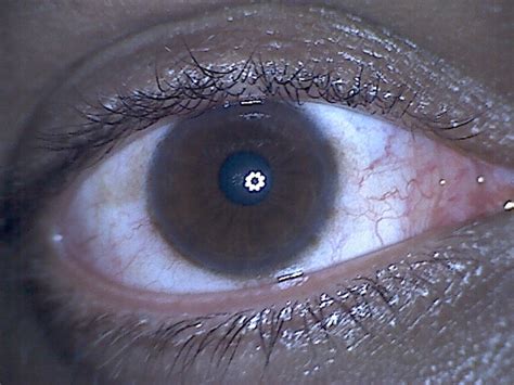 Cornea Iris Multimodal Database