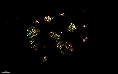 Using 3d Sim To Study The Replication Of Murine Polyomavirus Oxford