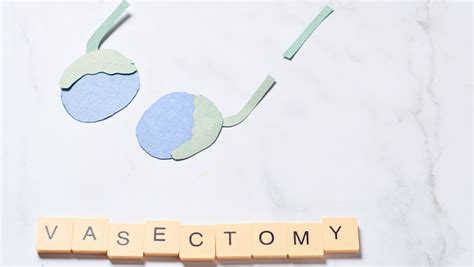 Minimally Invasive Vasectomy No Scalpel Desert Sky Urology