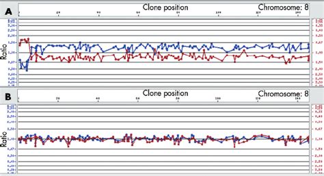 a array cgh profile 1 mb resolution of the proposita s chromosome
