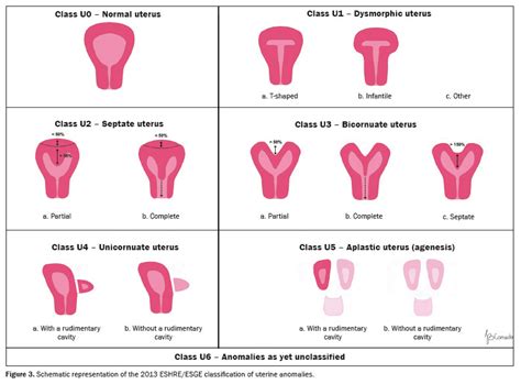 Radiologia Brasileira Critical Comparison Of American And European