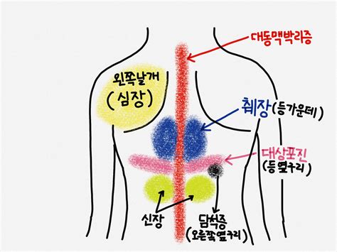 등 통증 부위별 의심 질환 원인과 해결 방법