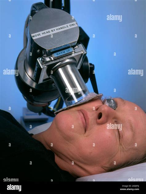 Radiotherapy Womans Head Undergoing Radiotherapy Treatment On A Skin