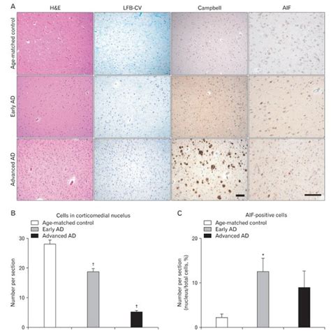 Apoptosis Inducing Factor Aif Immunohistochemistry In The
