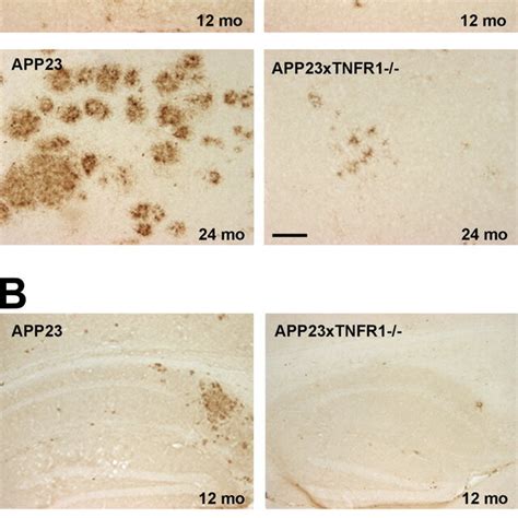 Microglia Activation Is Reduced In The Brains Of App23 Tnfr1− − Mice Download Scientific
