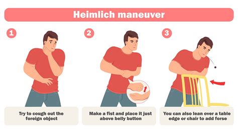 Cómo hacer la maniobra de Heimlich en caso de atragantamiento | Fox News
