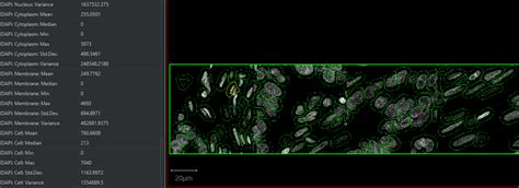 Using Cellpose Mask In Qupath Cell Detection Image Analysis Image