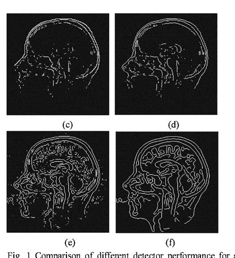 figure 1 from medical image edge detection method based on adaptive facet model semantic scholar