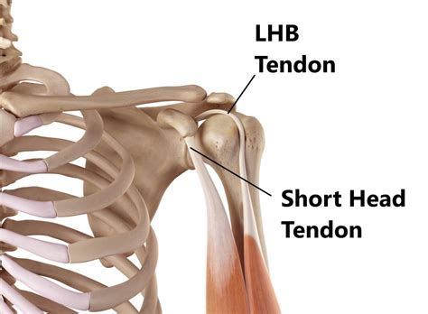 What Is Retraction Of The Biceps Tendon At Tony Beane Blog