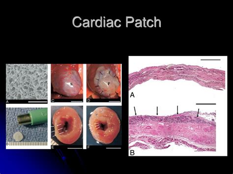 Ppt Innovations In Cardiovascular Tissue Engineering Powerpoint