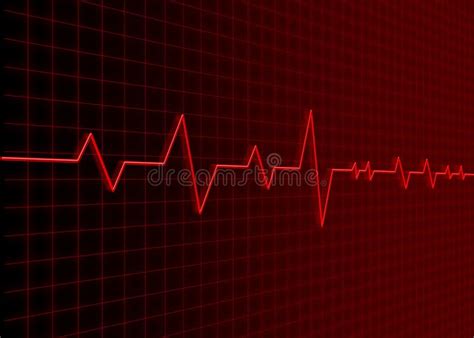 Electrocardiogram Stock Illustration Illustration Of Normal 31137743