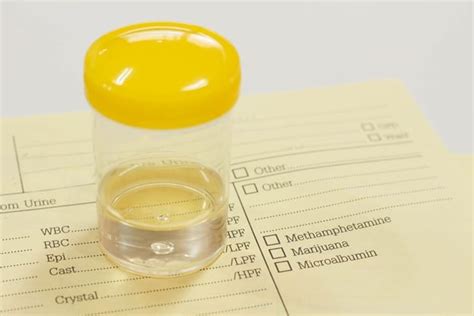 The Benefits Of Implementing A DOT Drug Testing Program Advantage Drug Testing