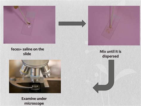 Ppt Preparation And Microscopic Examination Of A Direct Fecal Smear