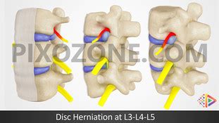Medical Scientific Illustrations Pixozone