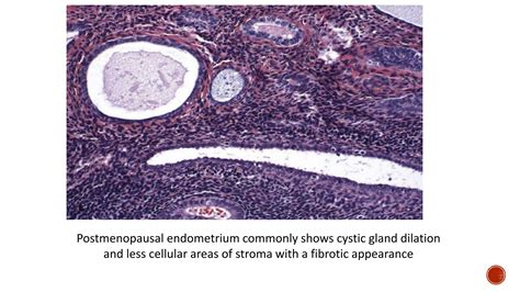 Dating Of Endometrium Female Genital Tract Pptx