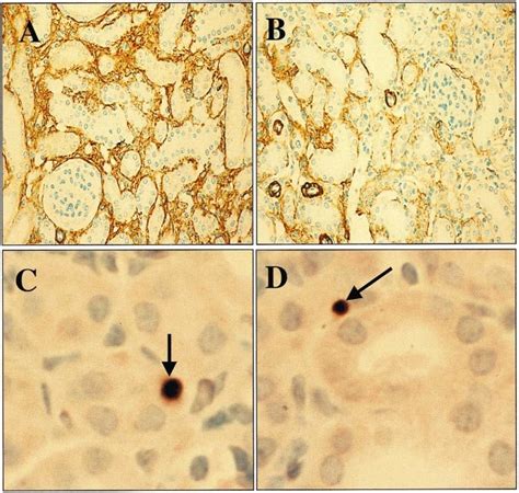 Interstitial Myofibroblast Accumulation And Detection Of Tubular Download Scientific Diagram