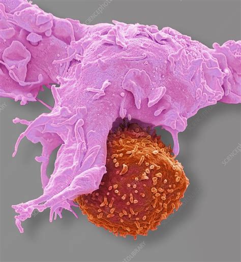 Antigen Presentation Sem Stock Image C0260621 Science Photo Library