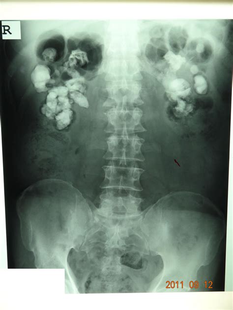 Urology Researchgate