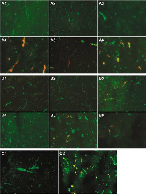 Detection Of C4c And C3d In Wt Mouse Brain After Cci A Download