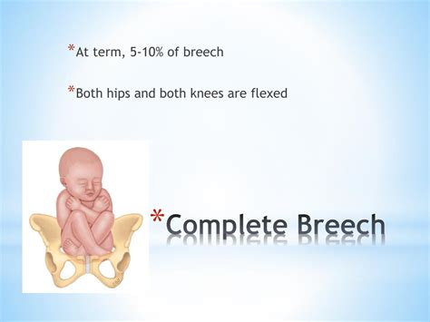 Ppt Breech Presentation Powerpoint Presentation Free Download Id