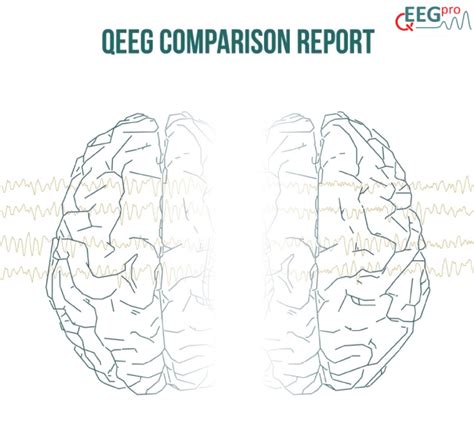 Download Sample Report Qeeg Pro