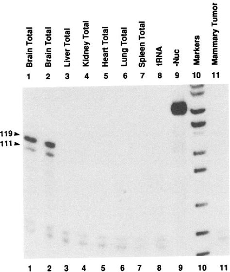 Figure 1 From Brain Specific Polya Transcripts Are Detected In Polya