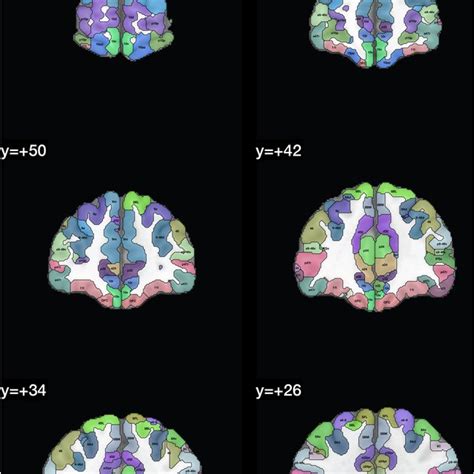 An Extended Human Connectome Project Multimodal Parcellation Atlas Of