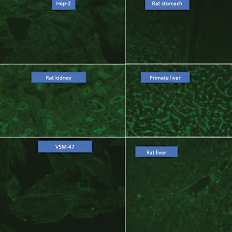 Indirect Immunofluorescence Technique Iift On Liver Mosaic 8 By Download Scientific Diagram