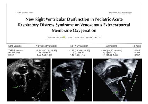 Elso The Extracorporeal Life Support Organization On Linkedin Ards