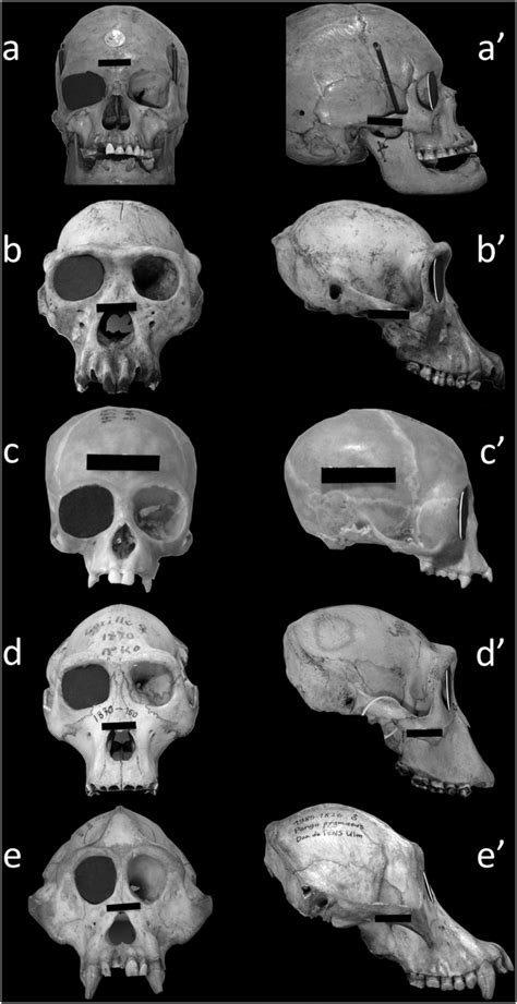 The Human Orbital Margin Falls Short Of Being Inscribed In A Plane