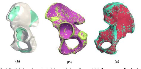 Figure From USING OF STATISTICAL SHAPE MODELS FOR PELVIS RECONSTRUCTION IN THE ONCOLOGIC