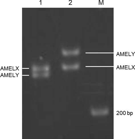 Comparison Of Pcr Products With Amel 1 Primer From The Amely Negative Download Scientific