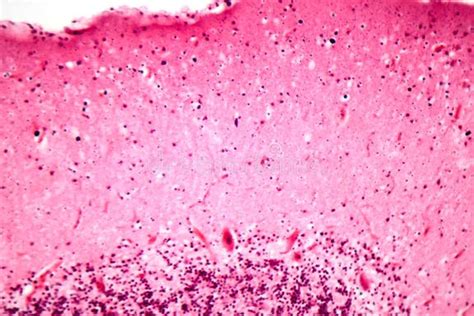 Human Motor Cortex Photomicrograph Showing Pyramidal Neurons In