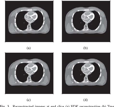 Figure 1 From Quadratic Regularization Design For 3 D Axial Ct