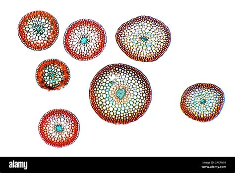 Moss Stems Light Micrograph Transverse Section Through Stems Of A