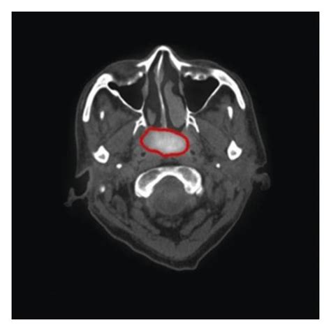 An Example Of The Feature Maps In The Fourth Upsampling Block A A