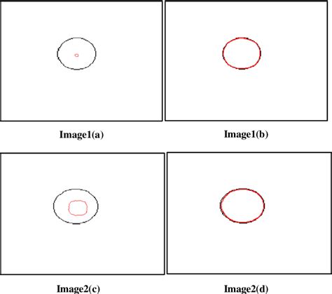 Figure 1 From Mri Images Series Segmentation Using The Geodesic