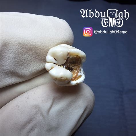 Abdullah Essam El Saied