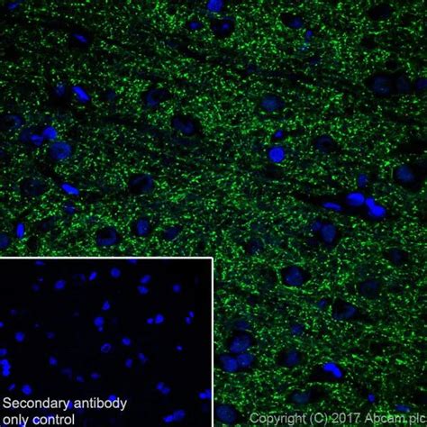 Anti Vglut2 Antibody [epr21085] Ab216463 Abcam