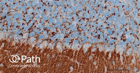 Connected Pathology Pathology Picture Of The Month This Image Shows Neuromuscular Junctions