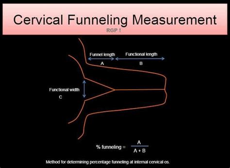 Pin By Kennedy Craven On Ultrasound Medical Ultrasound Obstetric